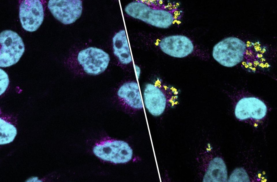 Scientists discover how Golden staph hides and thrives in human cells ...