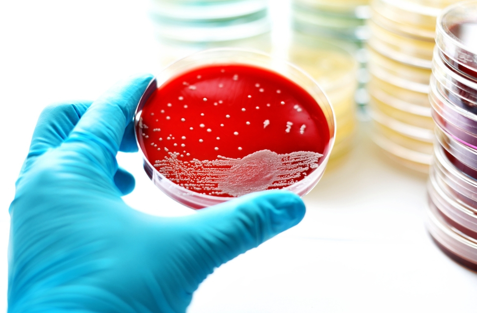 Researchers discover genes behind antibiotic resistance in deadly ...