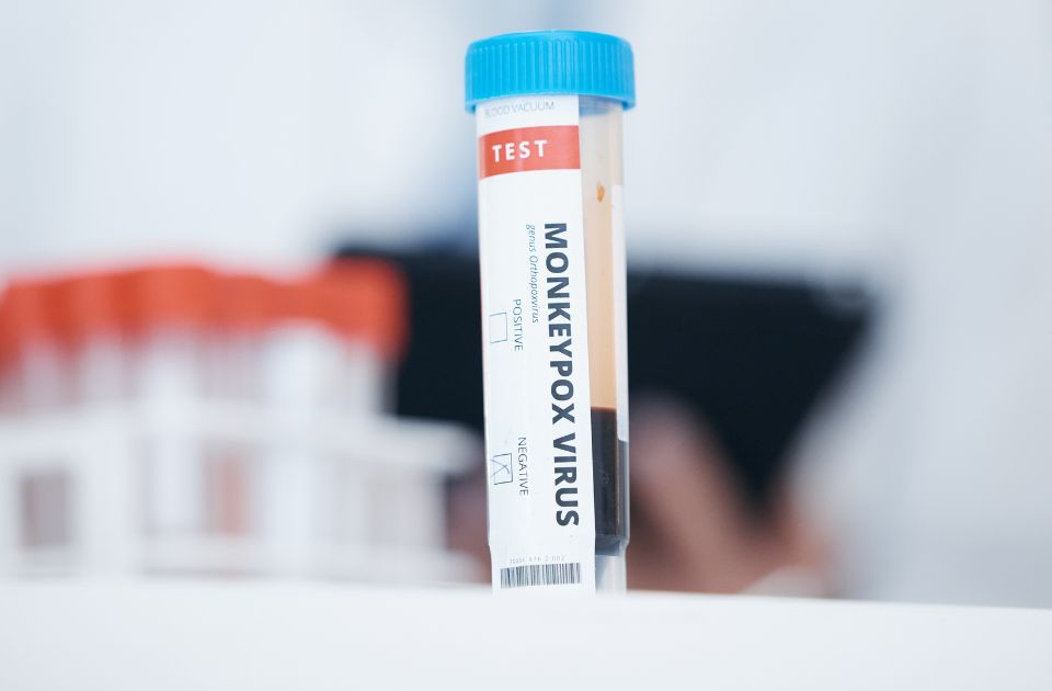 Unveiling Australia’s fastest next-gen mpox diagnostic tool | Doherty ...