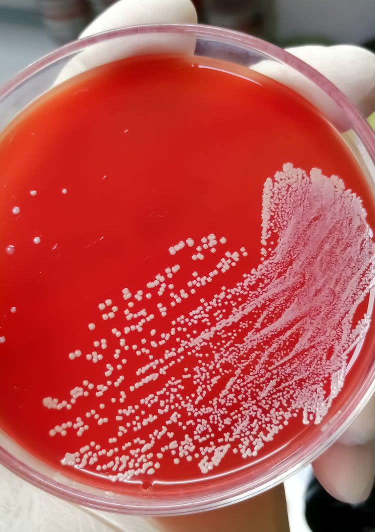 Antimicrobial Resistance