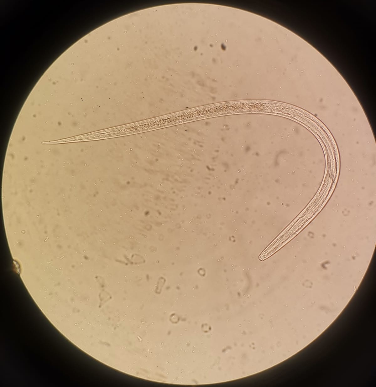 Towards eradication of strongyloidiasis in Australia | Doherty Website