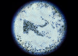 Australian Barmah Forest virus found in Papua New Guinea | Doherty Website