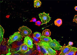 Decoding cancer cell communication | Doherty Website