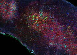 The biology and functional importance of MAIT cells | Doherty Website