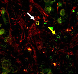 NIH facility provides MR1 tetramers developed at Doherty Institute ...