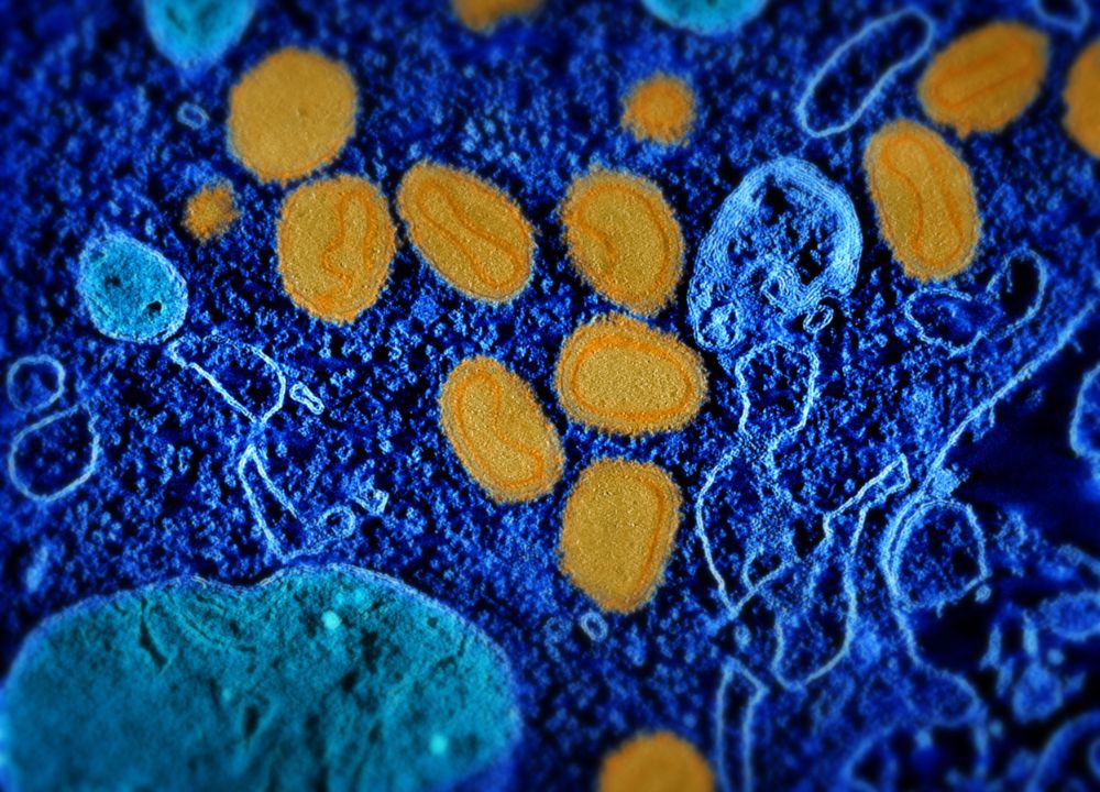 Monkeypox to be renamed ‘mpox’ following recommendation from WHO ...